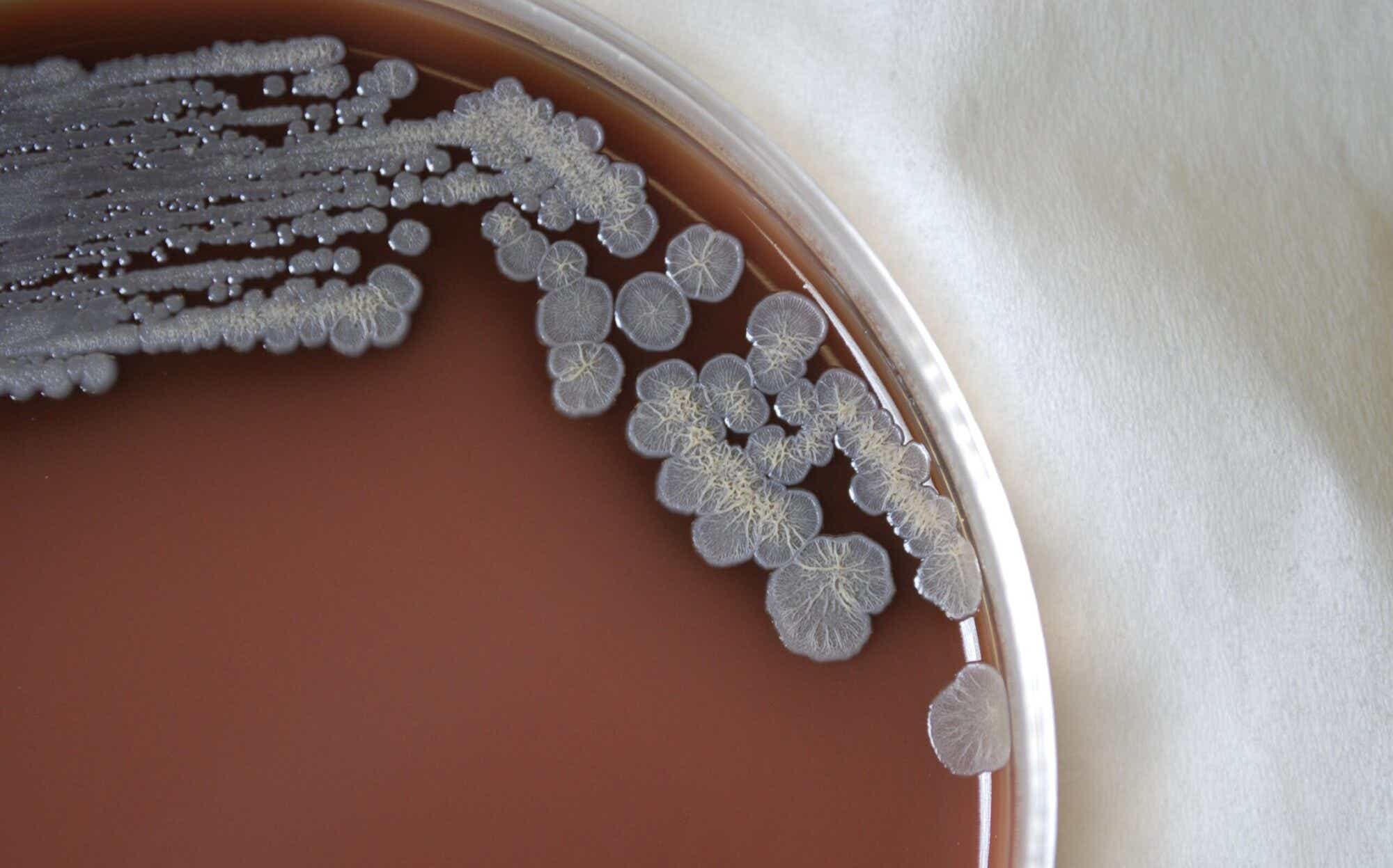 Potentially Deadly Bacteria Detected In The U.S. | KCM