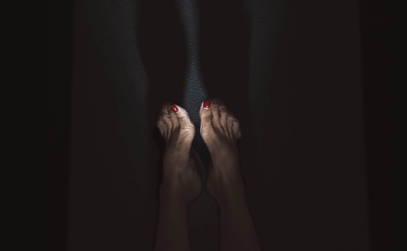 Crooked Toes: Types, Cause, Treatments, Pain