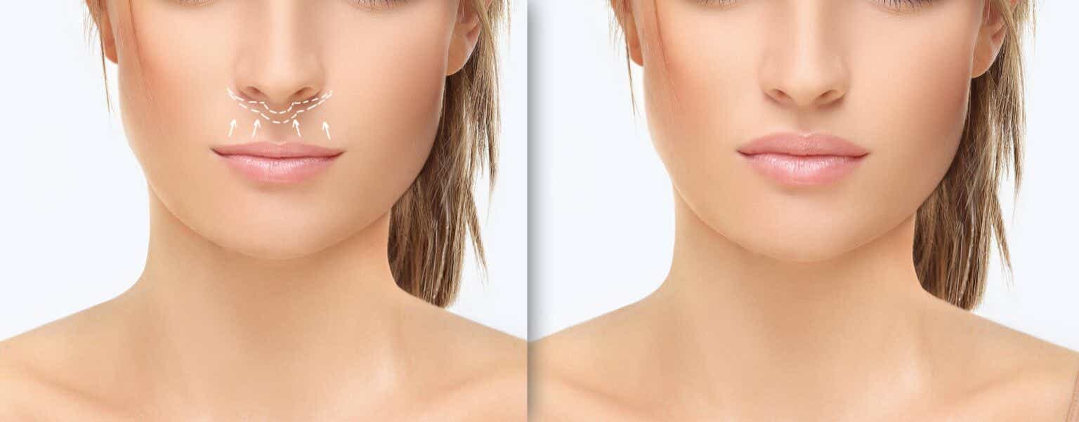 Weird and Crazy Plastic Surgery Trends You Didn't Know Existed