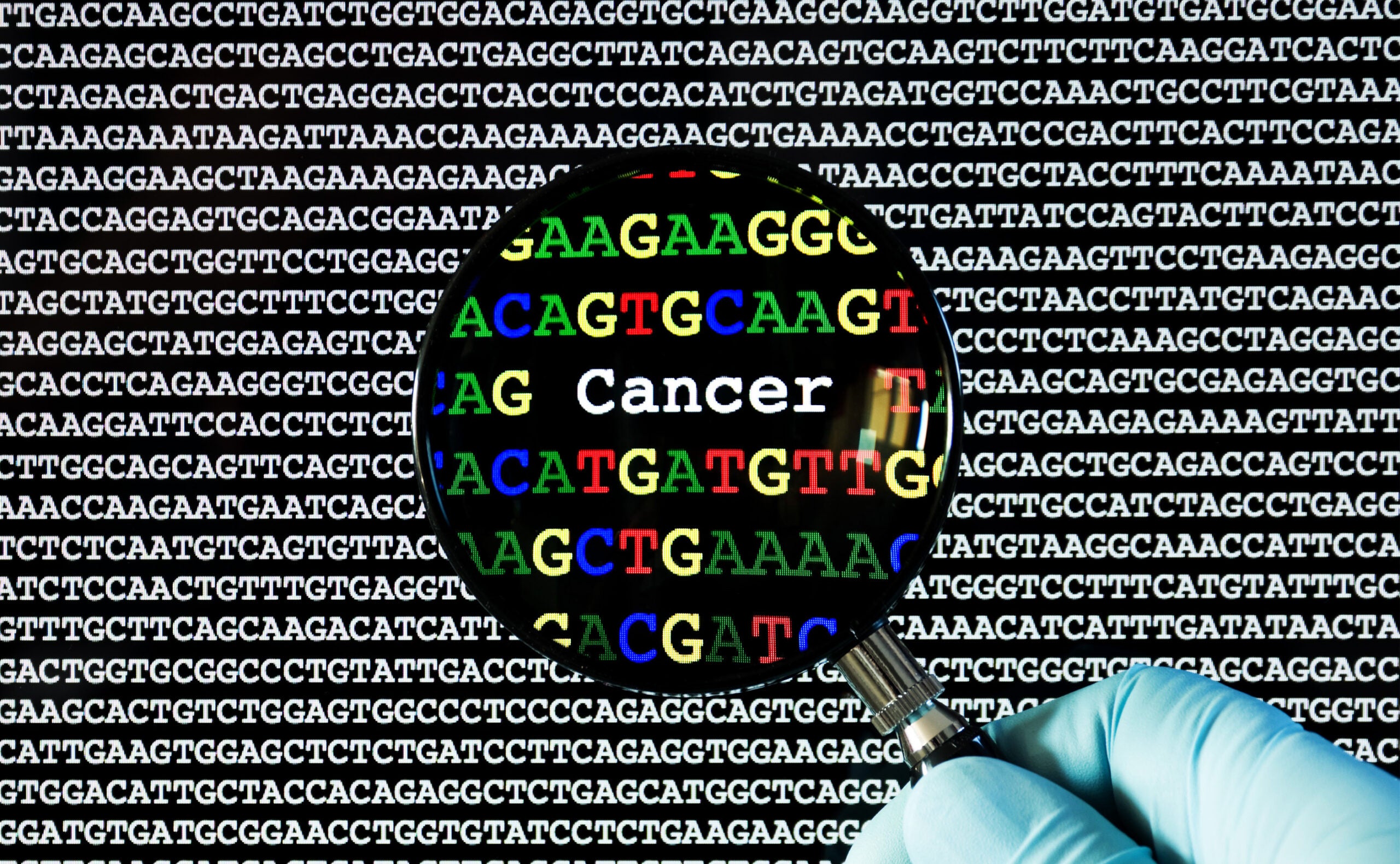 Tips for Finding the Best Cancer Doctor, Hospital & Treatment