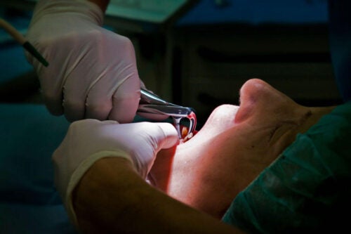 Dental Implant Scams on the Rise & How to Avoid