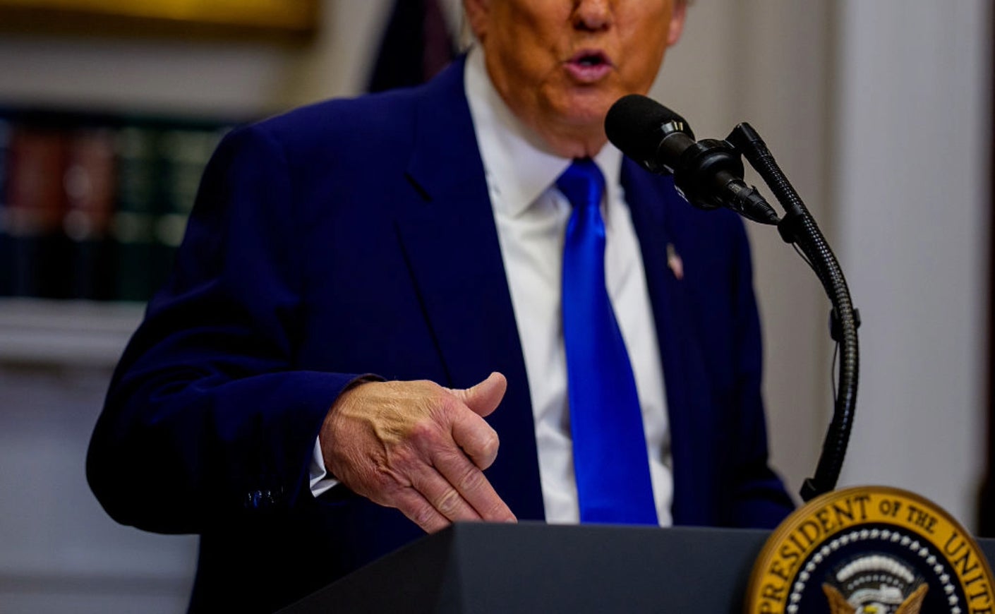 Trump’s Hand Bruises and Swelling Spark New Health Speculation