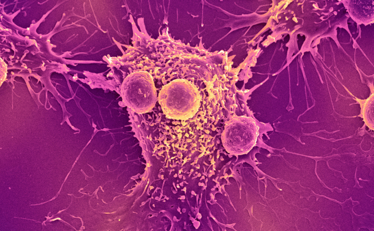 How Covid-19 Mrna Vaccines Could Help Cancer Treatment